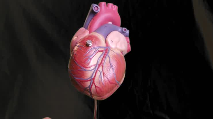 Heart model summary