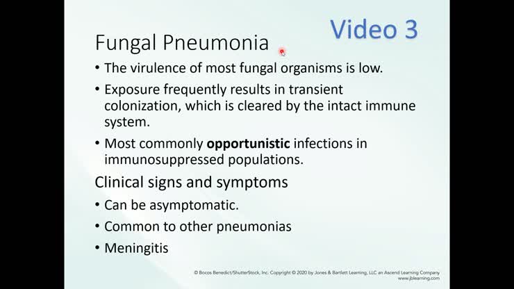 3. Fungal Pneumonia