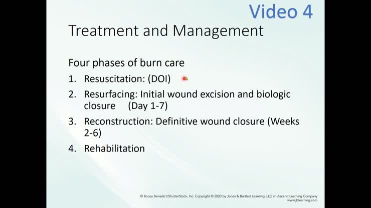 4. Burn Treatment