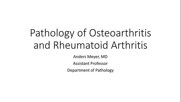 B6-007 Prework 4 Pathology of Osteoarthritis and Rheumatoid Arthritis
