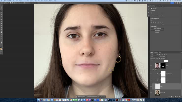 Basic Clone Technique