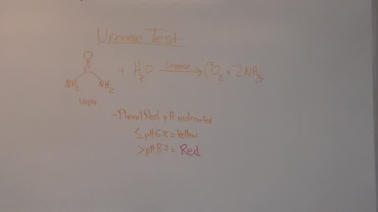 Urease Test-preparation