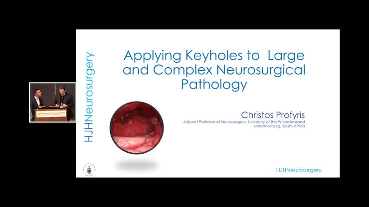 Applying Keyholes to Large and Complex Neurosurgical Pathology