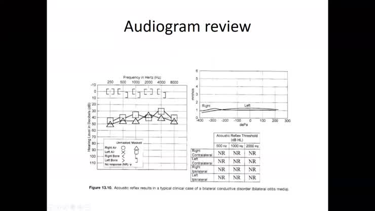 Module 1: Audiogram Review