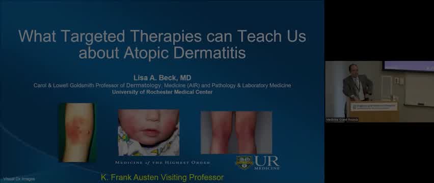 K. Frank Austen Visiting Professor: What Targeted Therapies can Teach ...