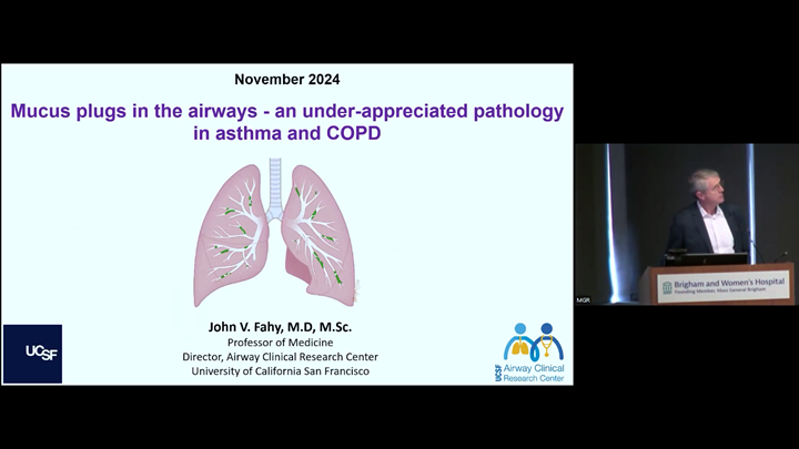 Mucus plugs in the airways- an under-appreciated pathology in asthma ...