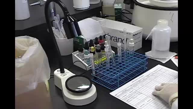 Washing RBCs for suspension