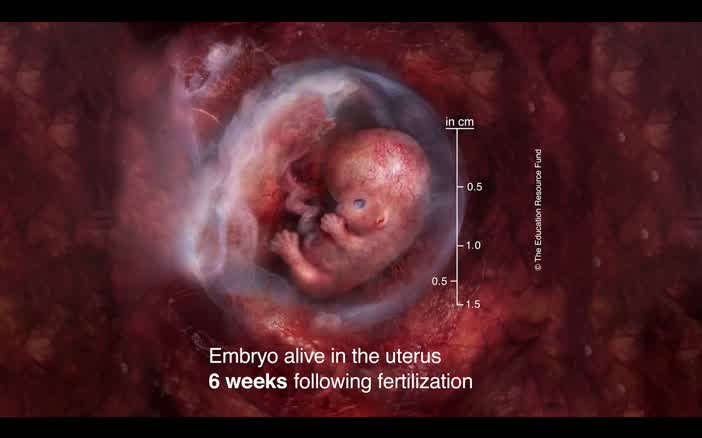 Week 6 – Embryonic & Fetal