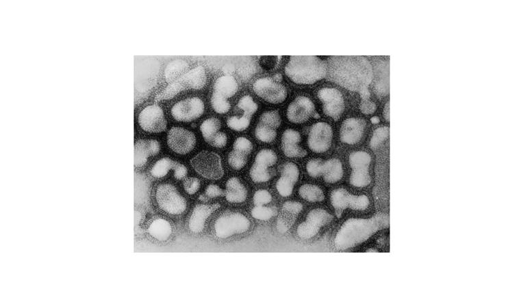Influenza Lecture