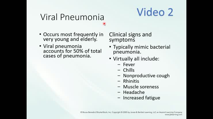 2. Viral Pneumonia