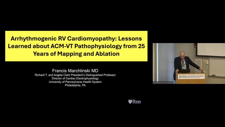 Arrhythmogenic RV Cardiomyopathy: Lessons Learned about ACM-VT ...