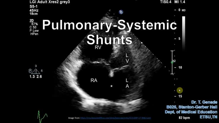 18 shunts edt 20Jan23 b