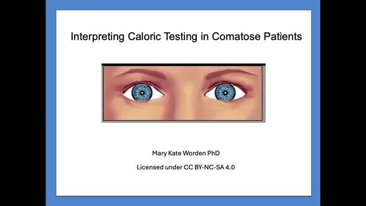 Interpreting Caloric Testing in Unconscious Patients