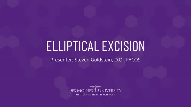 Lab 3. Skill: Elliptical Excision