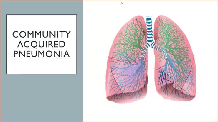 Community Acquired Pneumonia