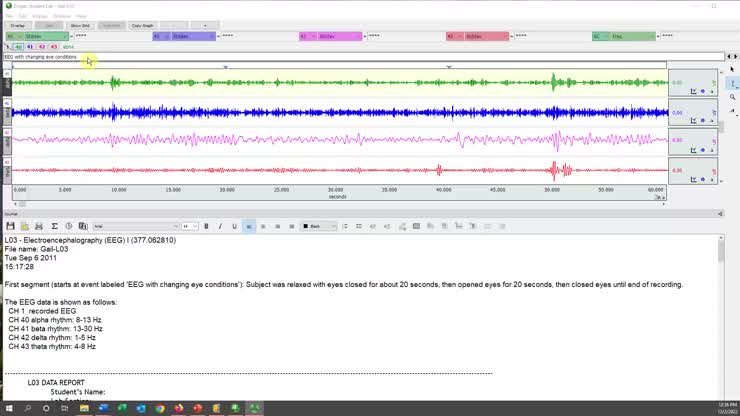BioPac EEG Sample Analysis Guide