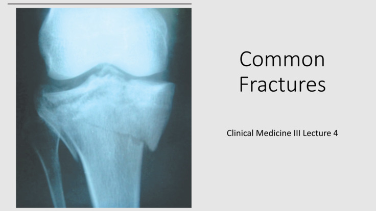 CM III Lecture 4 Fracture and Dislocation
