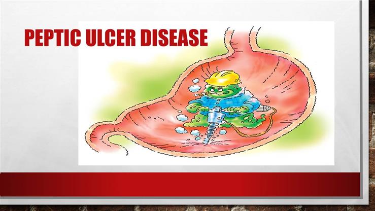 Peptic Ulcer Disease