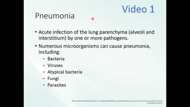 1. Bacterial Pneumonia