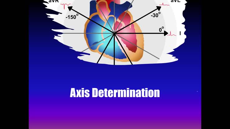 Axis Determination