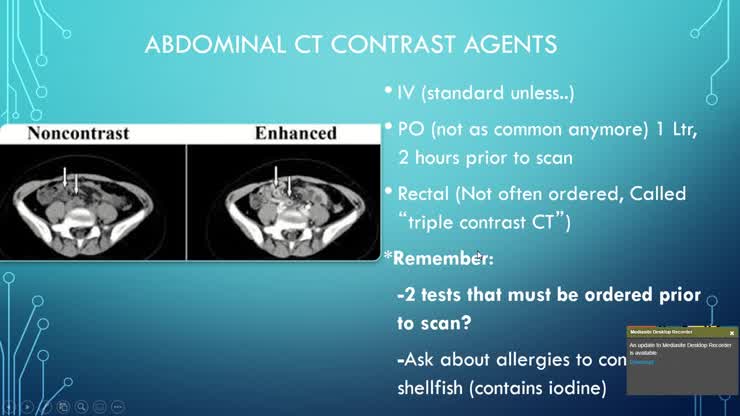 Abdominal Imaging & Procedures: CT and Paracentesis