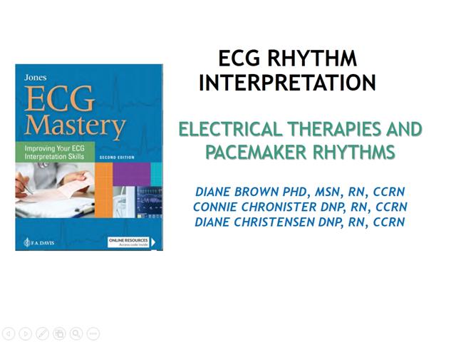 ECG interpretation: Electrical therapies_Jones_5-11-2021