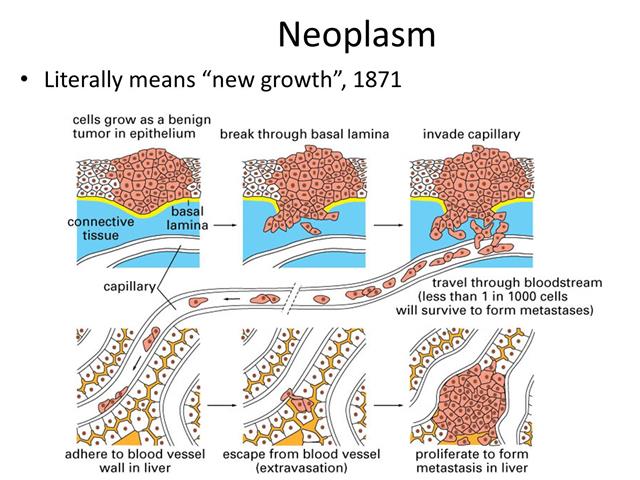 SOSNOWSKI Neoplasm Terminology/Pediatric Solid Neoplasms ONC SPR 2023