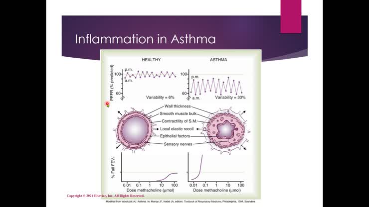 Definition of Asthma (Part 2)