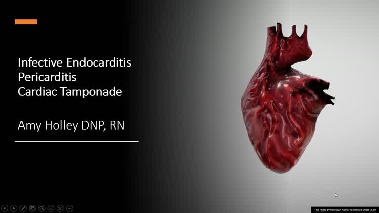 Infective Endocarditis, Pericarditis, Cardiac Tamponade