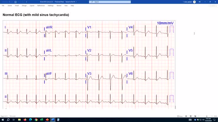 Introduction to ECG