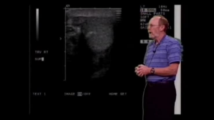 Basics of Testicular Sonography-Normal exam