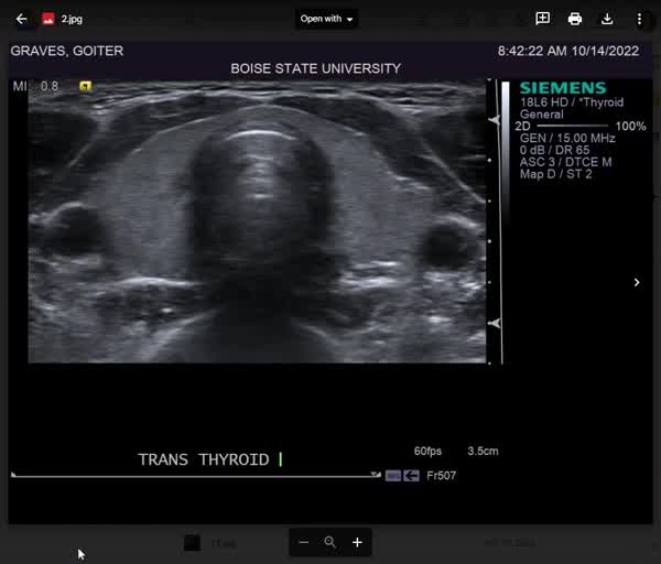 Example Thyroid Competency