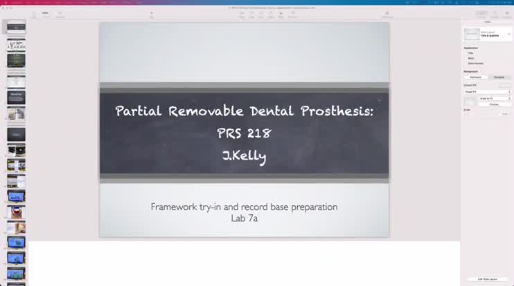 PRS 218: Lab 7a Framework fabrication, and record base preparation